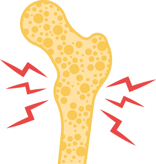 Pepermpron – Canva