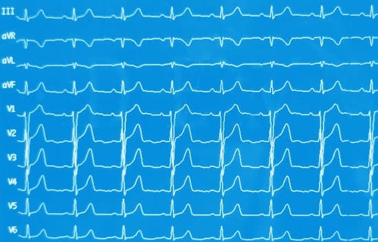 reddees Images – Canva